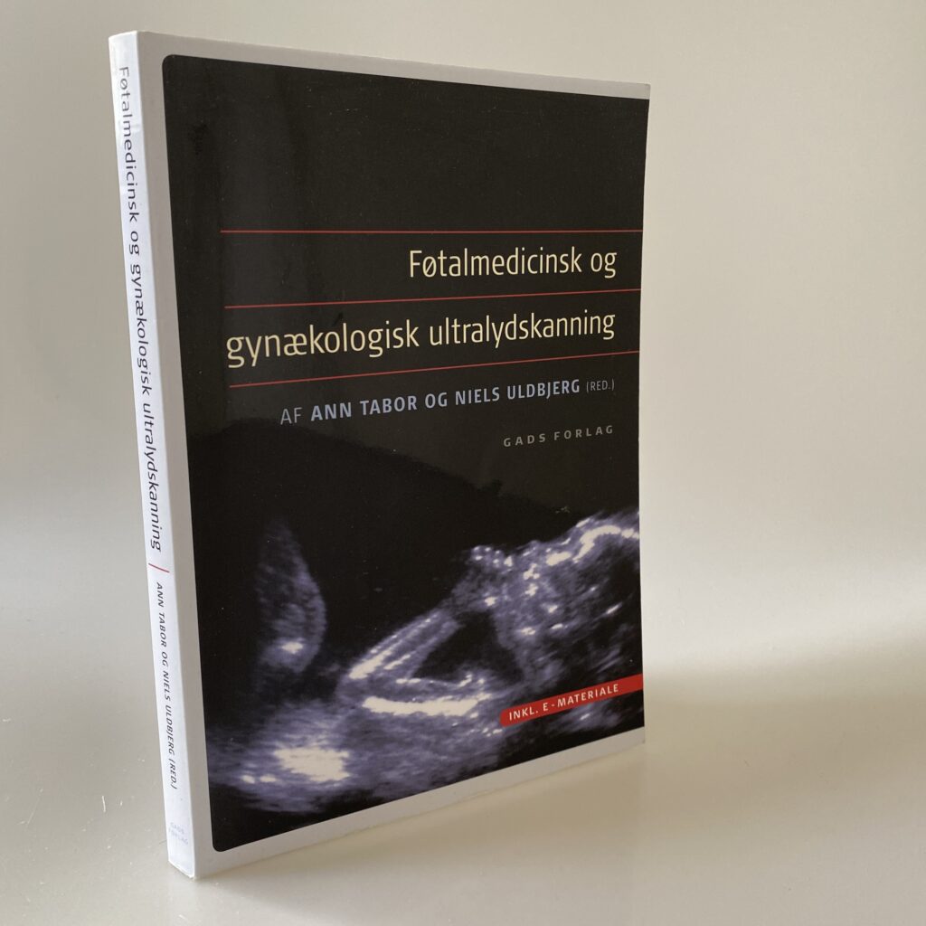 Ann Tabor og Niels Uldbjerg (red.): Føtalmedicinsk og gynækologisk ...